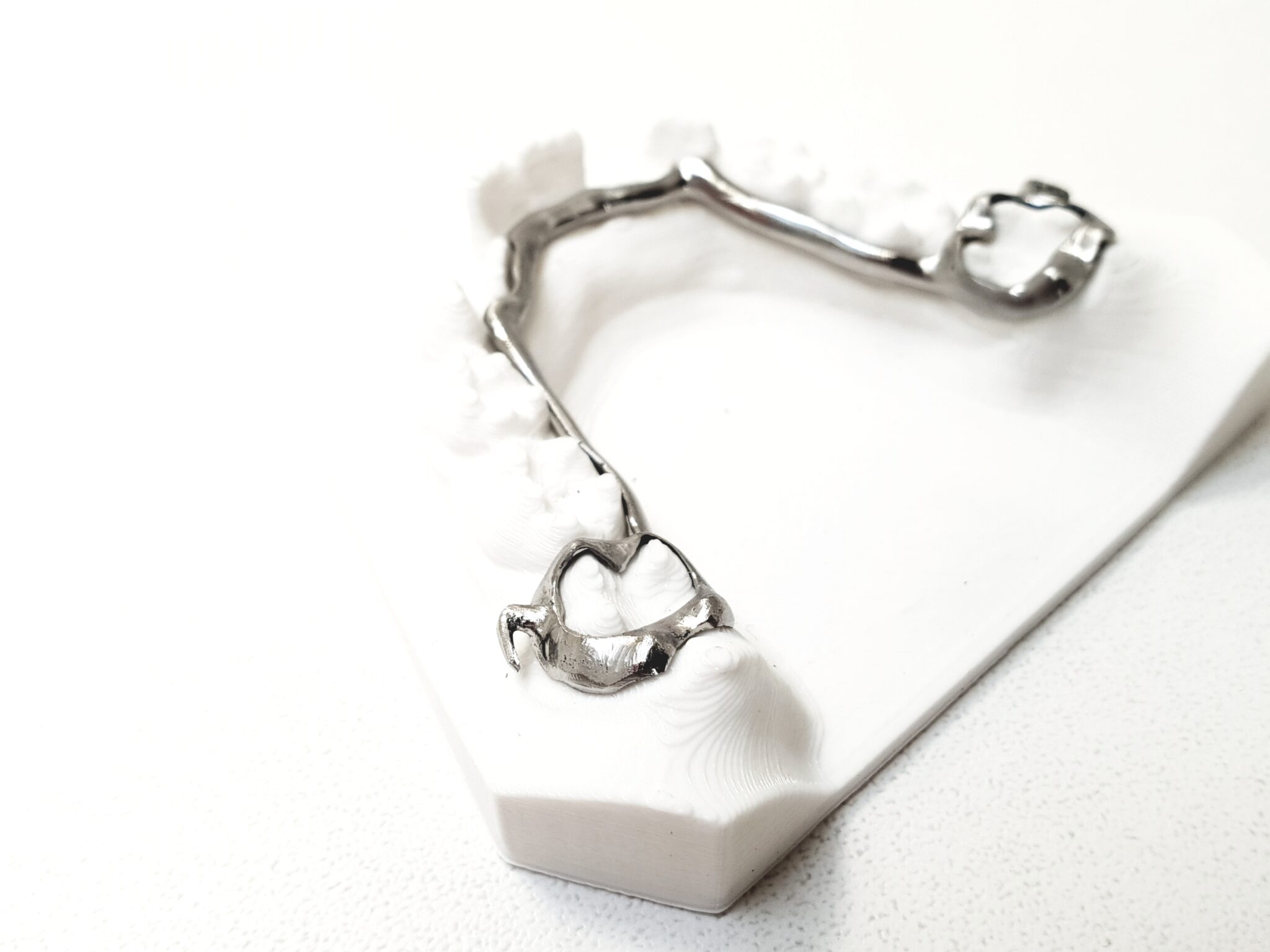 Appareil dentaire Belgique, Bruxelles 🦷 Sur-mesure